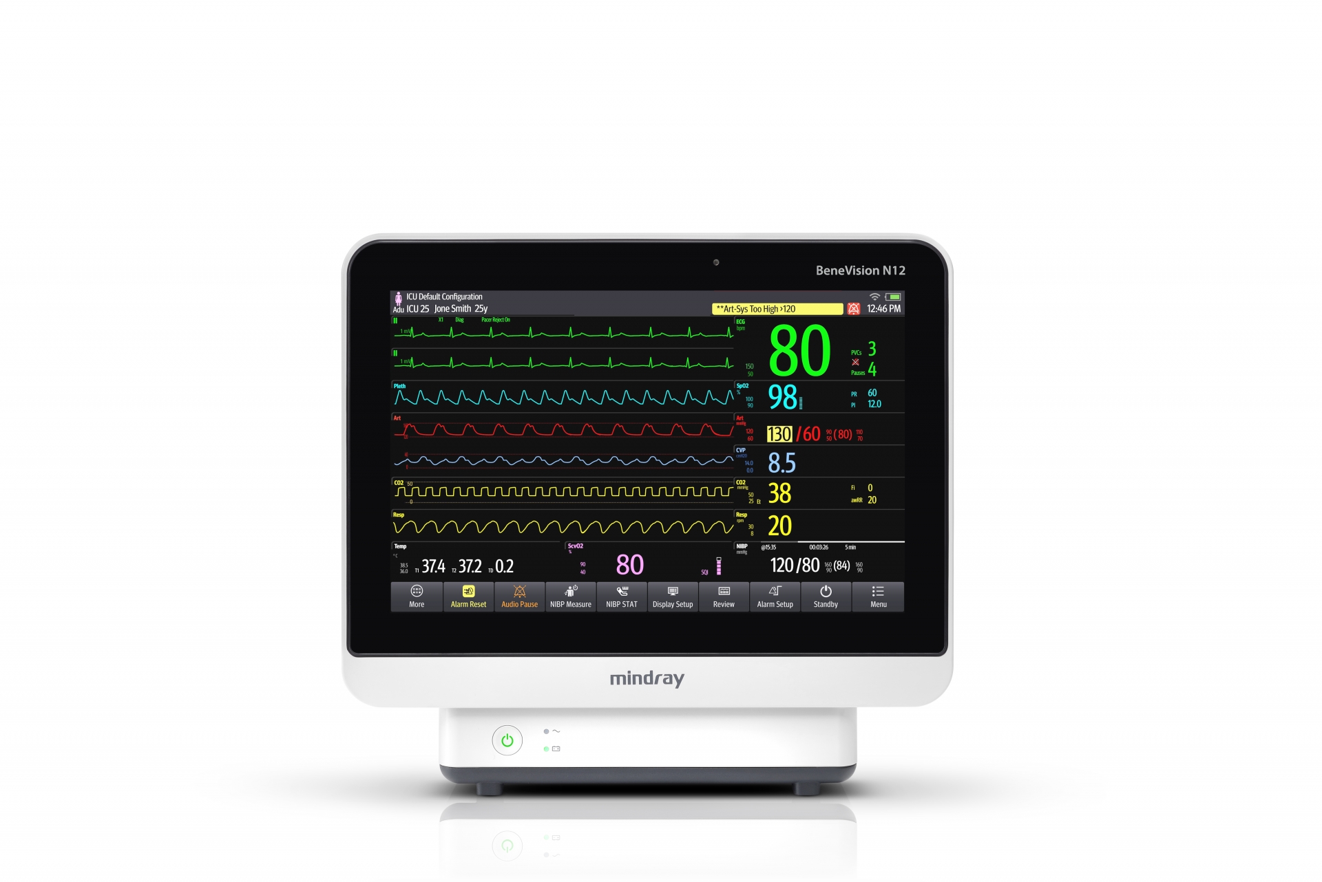 Mindray BeneVision N12 | Standard | 6630B-PA00040